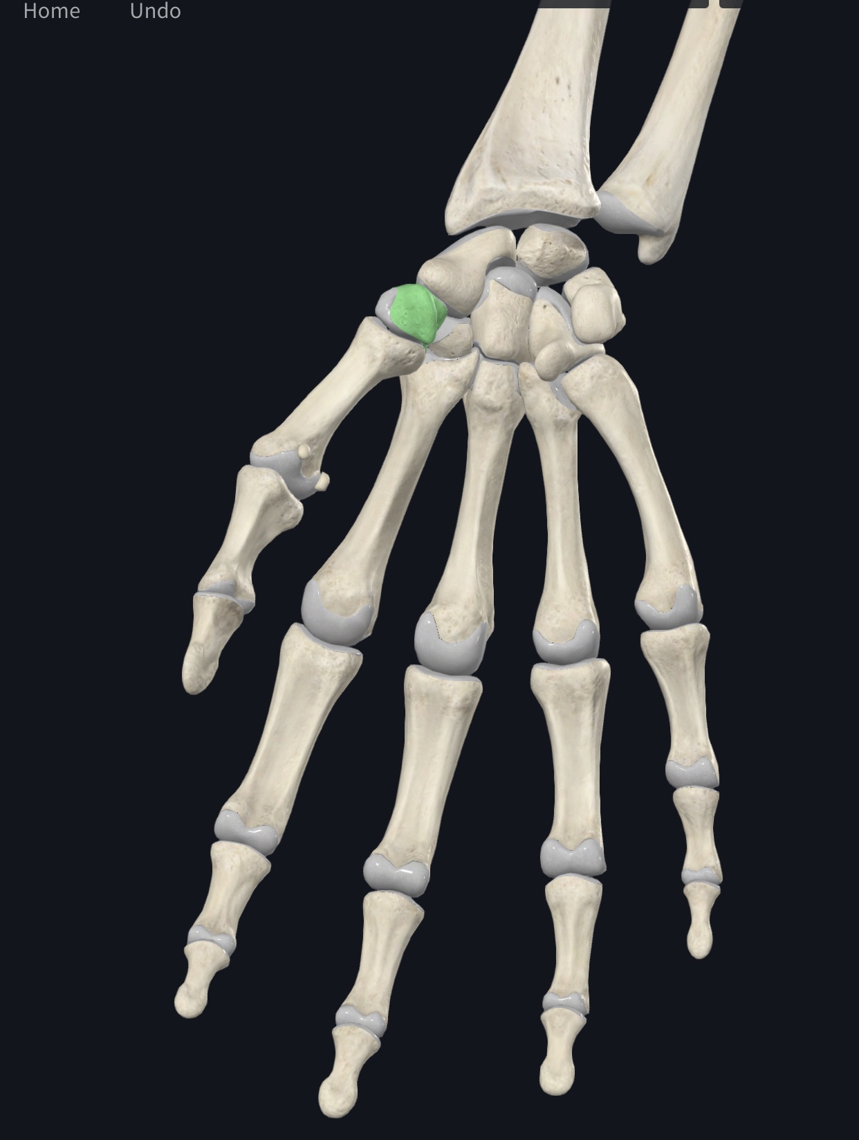 Carpometacarpal (CMC) Joint Pain – Williams Therapy Services, Inc.